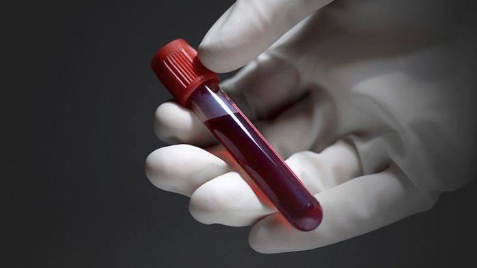 30 common blood tests and their cost - Nigerian Health Blog
