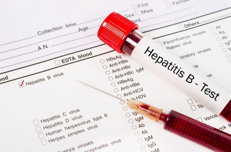 All you need to know about hepatitis b viral load test - Nigerian ...