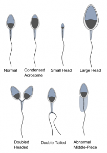 Seminal Fluid Analysis (SFA) : All you need to know - Nigerian Health Blog