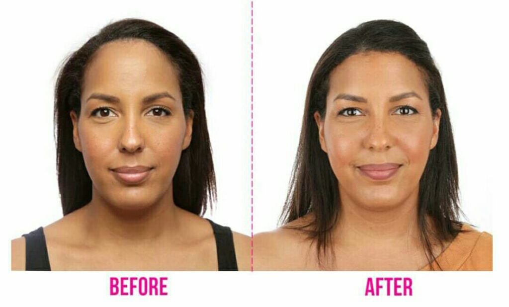 How much is the cost of forehead reduction surgery in Nigeria ...