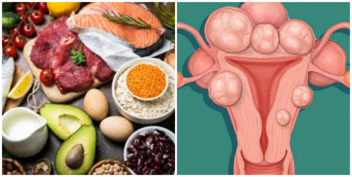 Diet Plan for fibroid patient in Nigeria - Nigerian Health Blog
