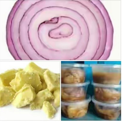 How to use python oil for stretch marks and Scars - Nigerian Health Blog