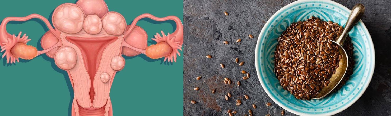 7 foods for shrinking fibroids - Nigerian Health Blog